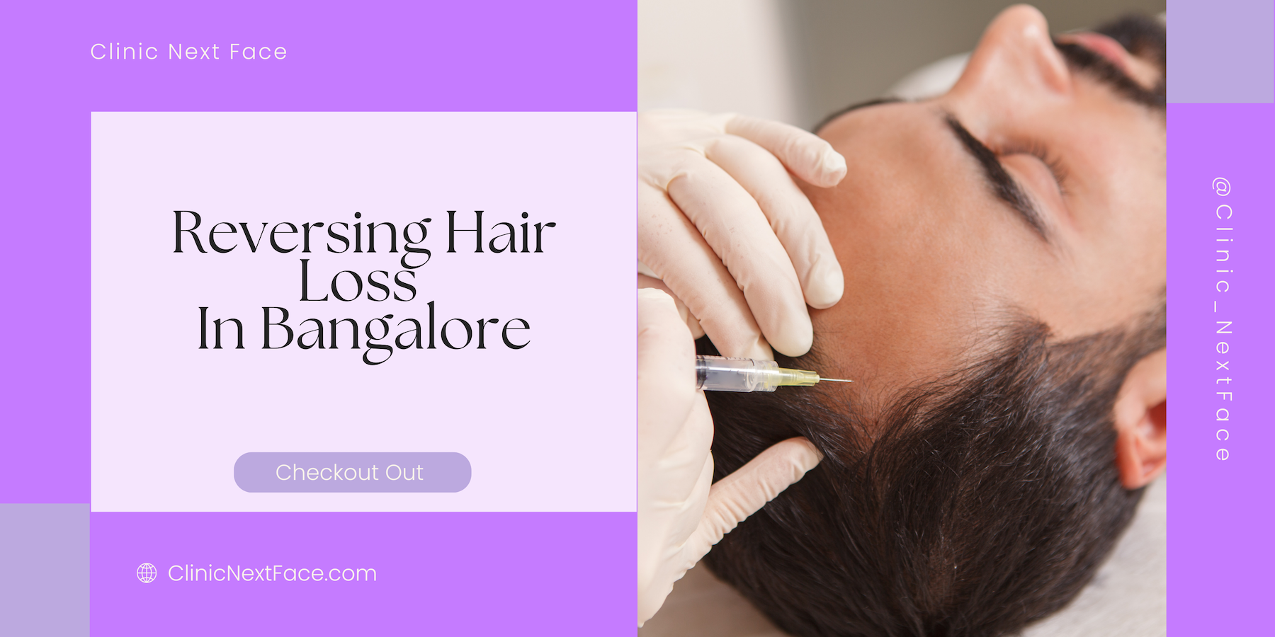 How To Reverse Hair Loss In Bangalore - Clinic Next Face