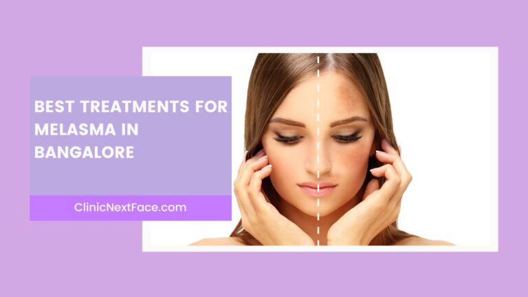 Best Dermatologist for Melasma in Bengaluru - Clinic Next Face