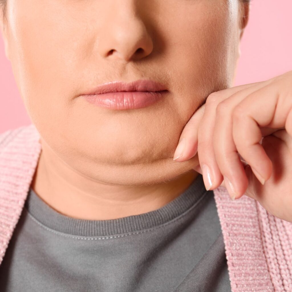Non-Surgical Double Chin Treatment Cost Starts @ 14000/-
