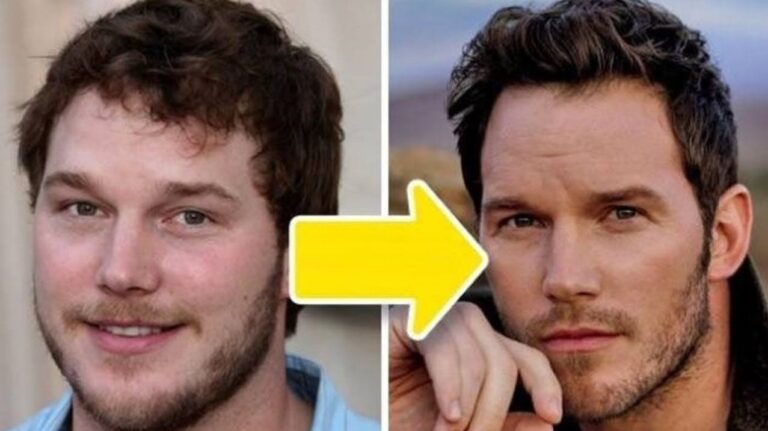 Can Facial Fat Impact The Way You Look? - Clinic Next Face