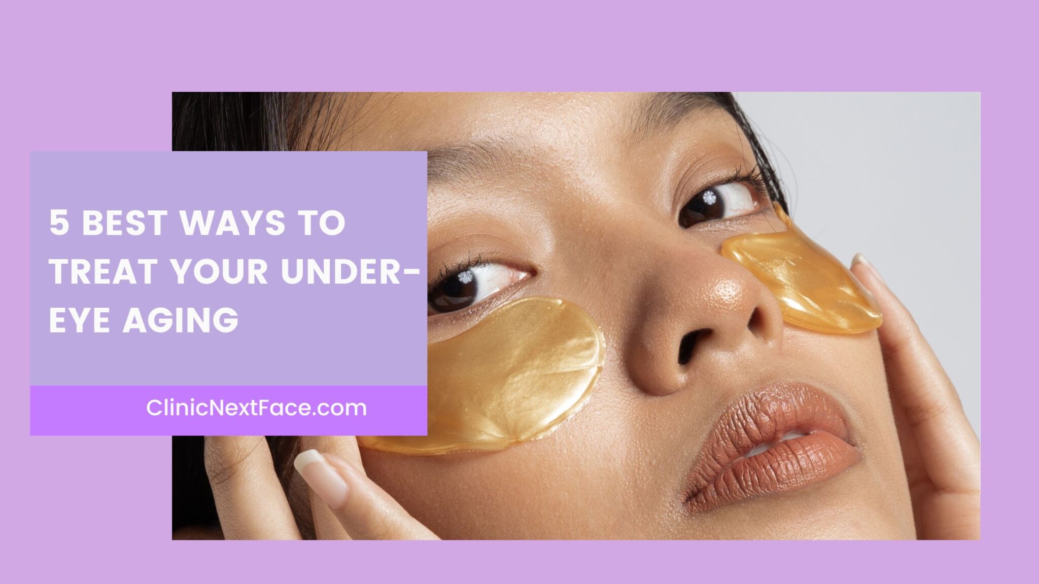 5 Best Ways To Treat Wrinkles Around Eyes (Under Eye Ageing)