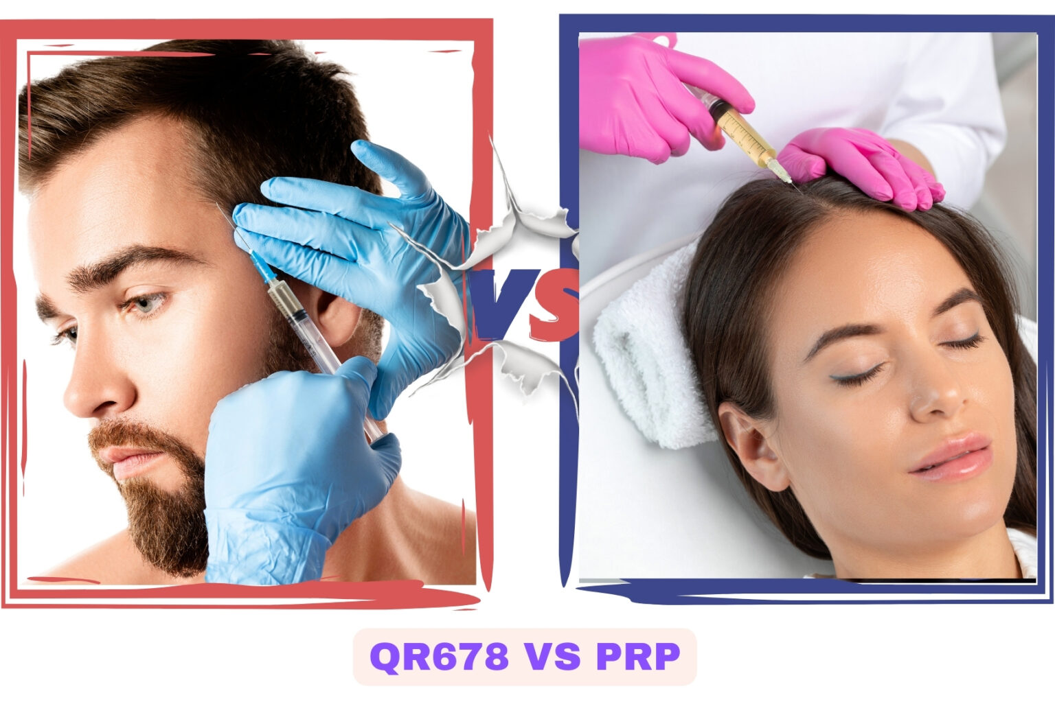 QR678 Vs. PRP - Clinic Next Face